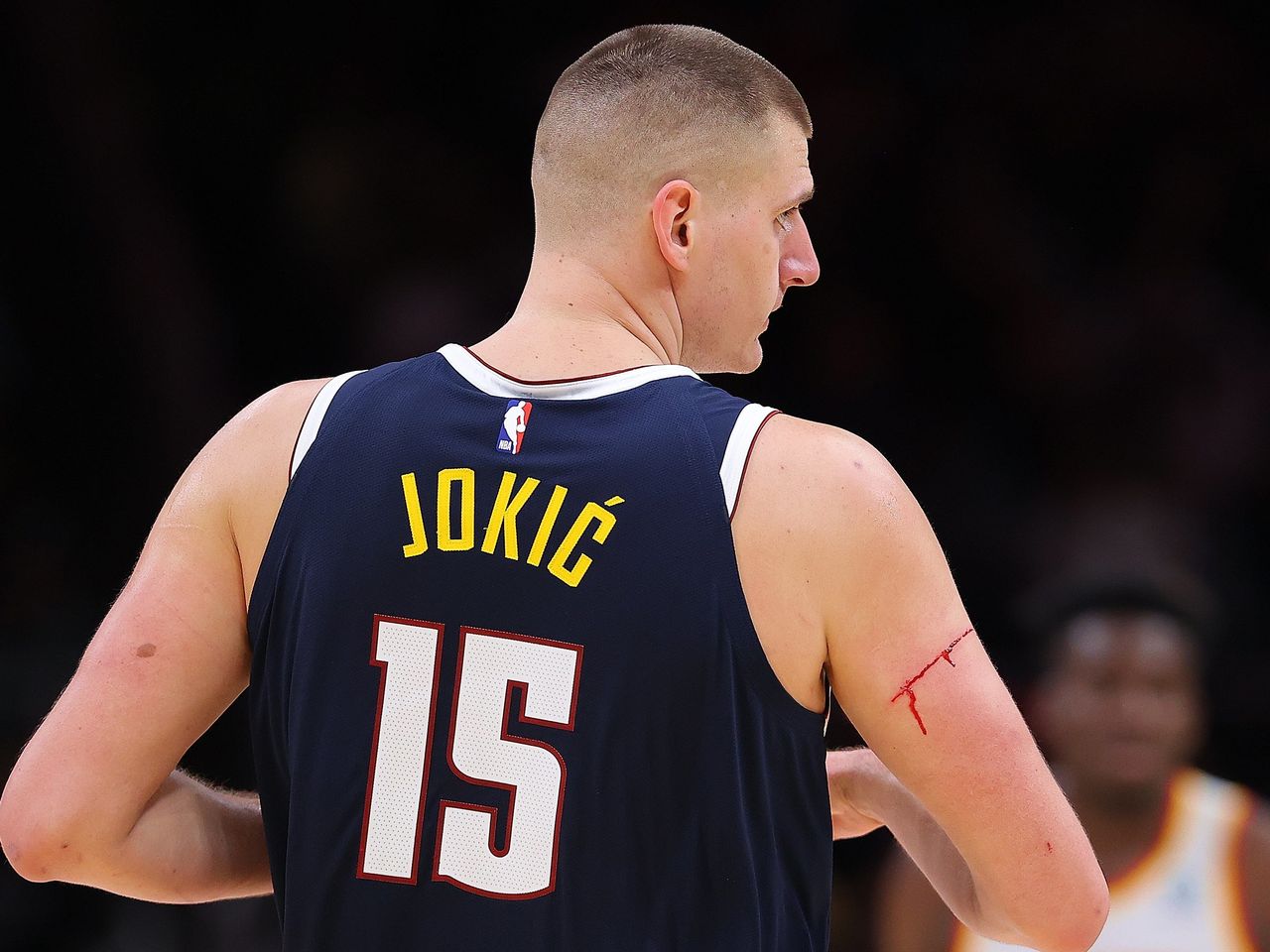 jokic-bleeding – Bear Claw Media